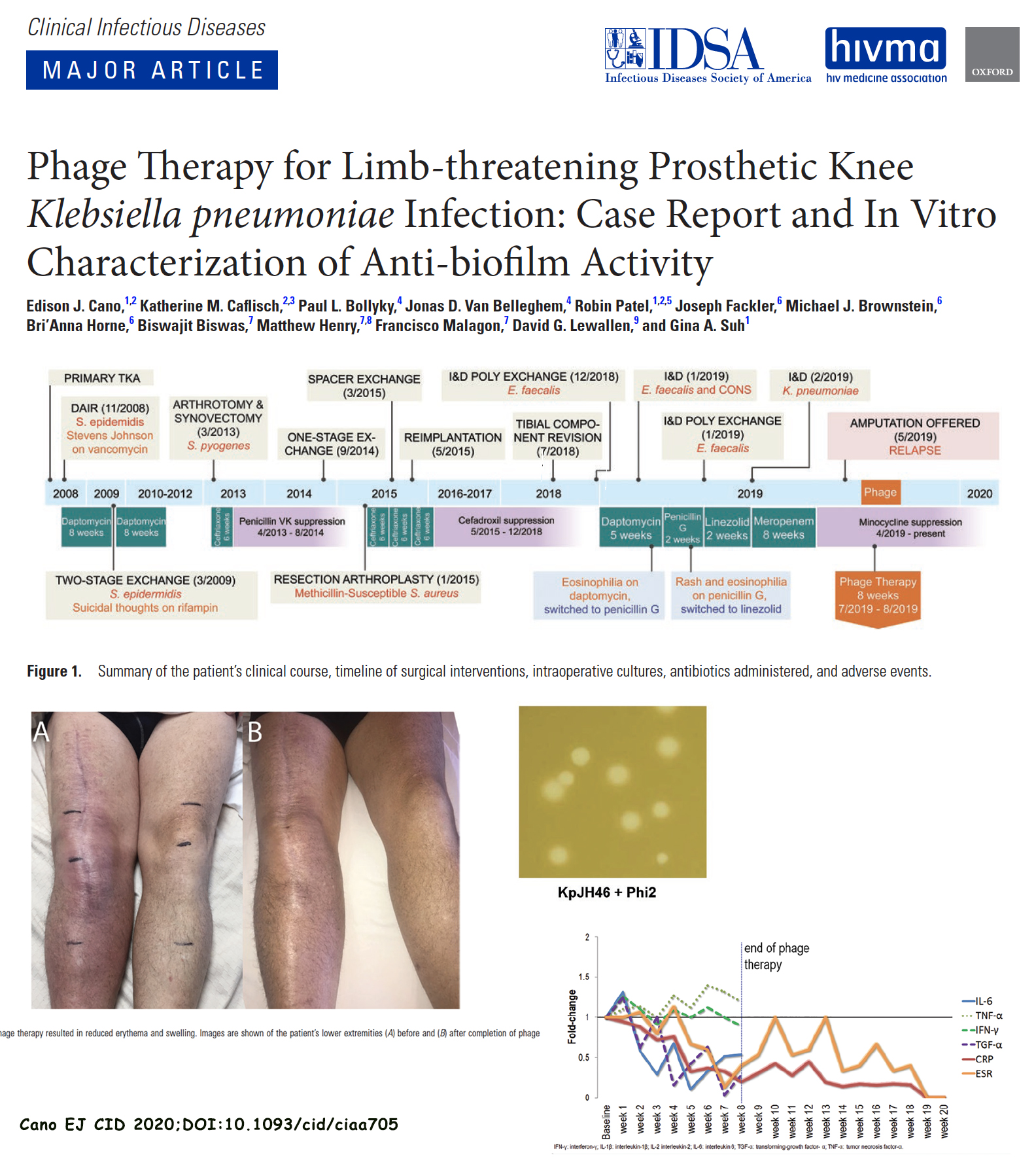 Phage/antibiotic cocktail, Dr. Gina Suh, cure a prosthetic knee ...